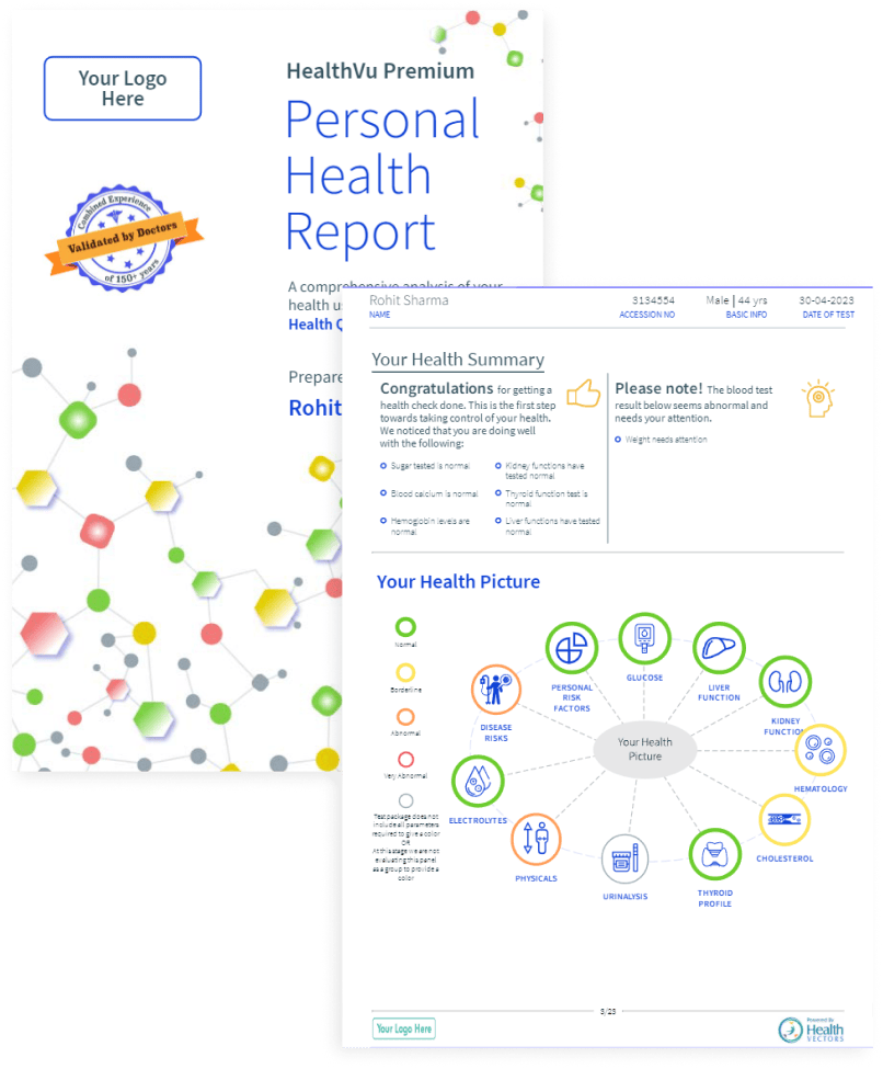 Smart Report: Personalized Health Analytics Report